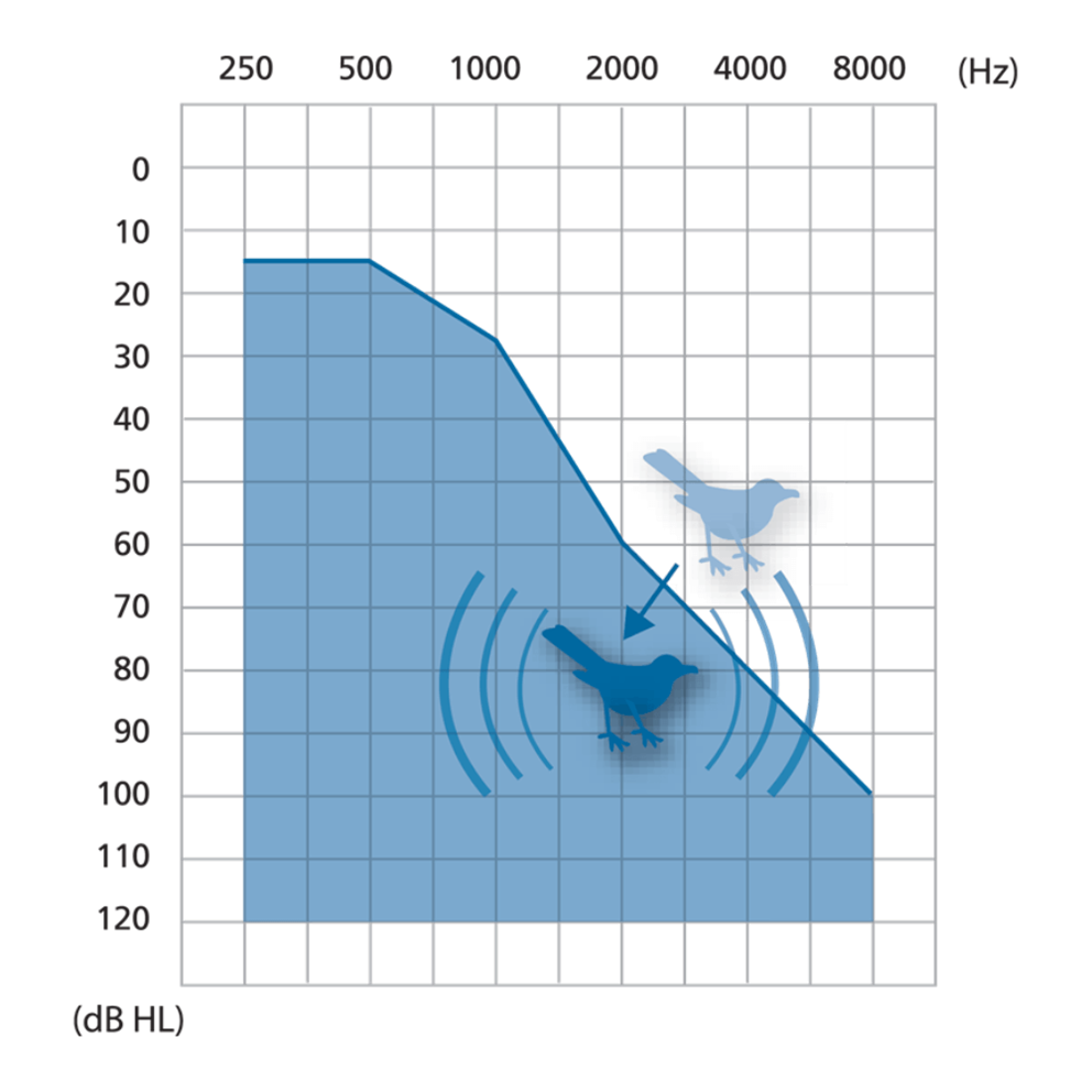 Frequency Transposition - Audibility Extender