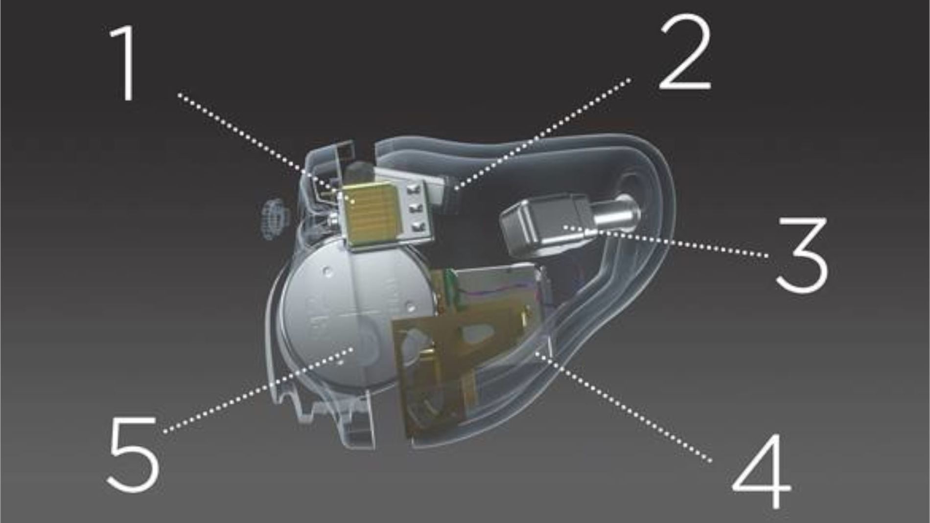 Widex Custom™ ITE hearing aids | Widex Pro