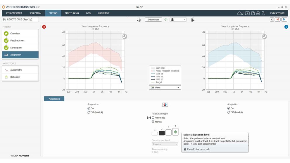 Widex Compass hearing aid fitting software - Download/update | Widex Pro