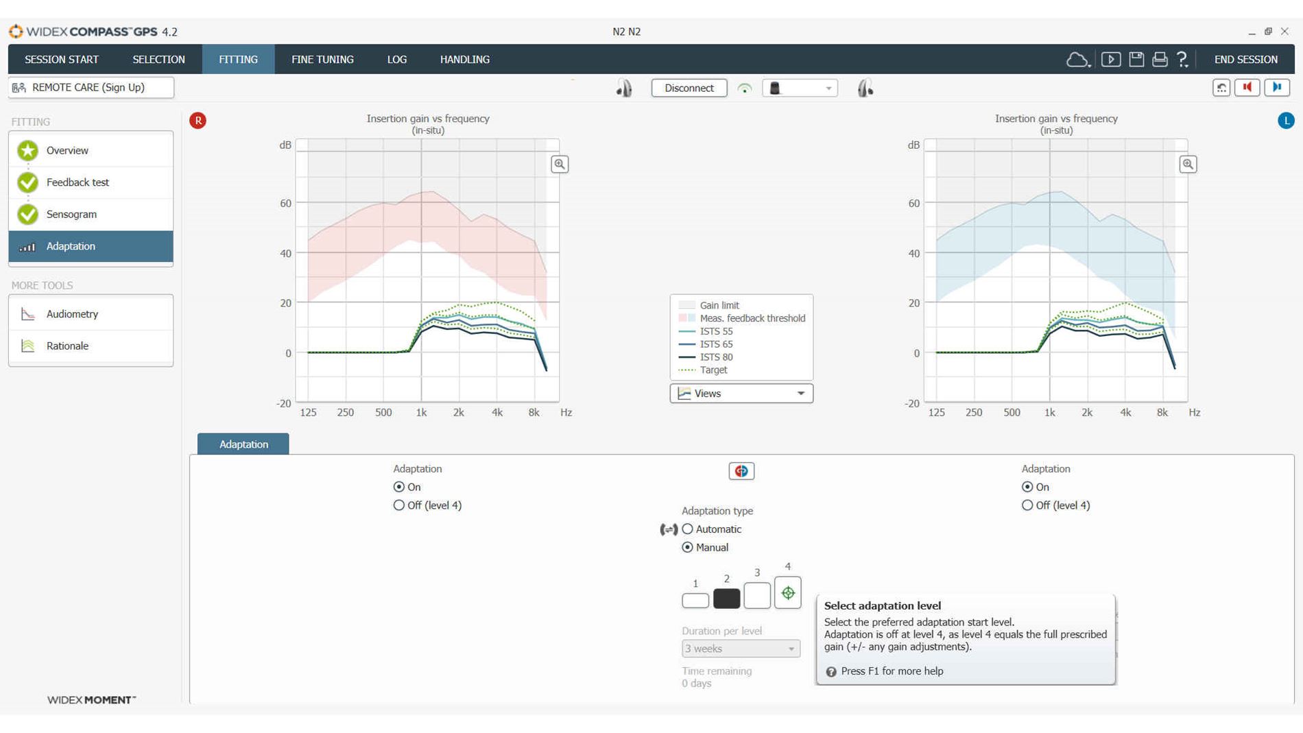 Widex Compass hearing aid fitting software - Download/update | Widex Pro