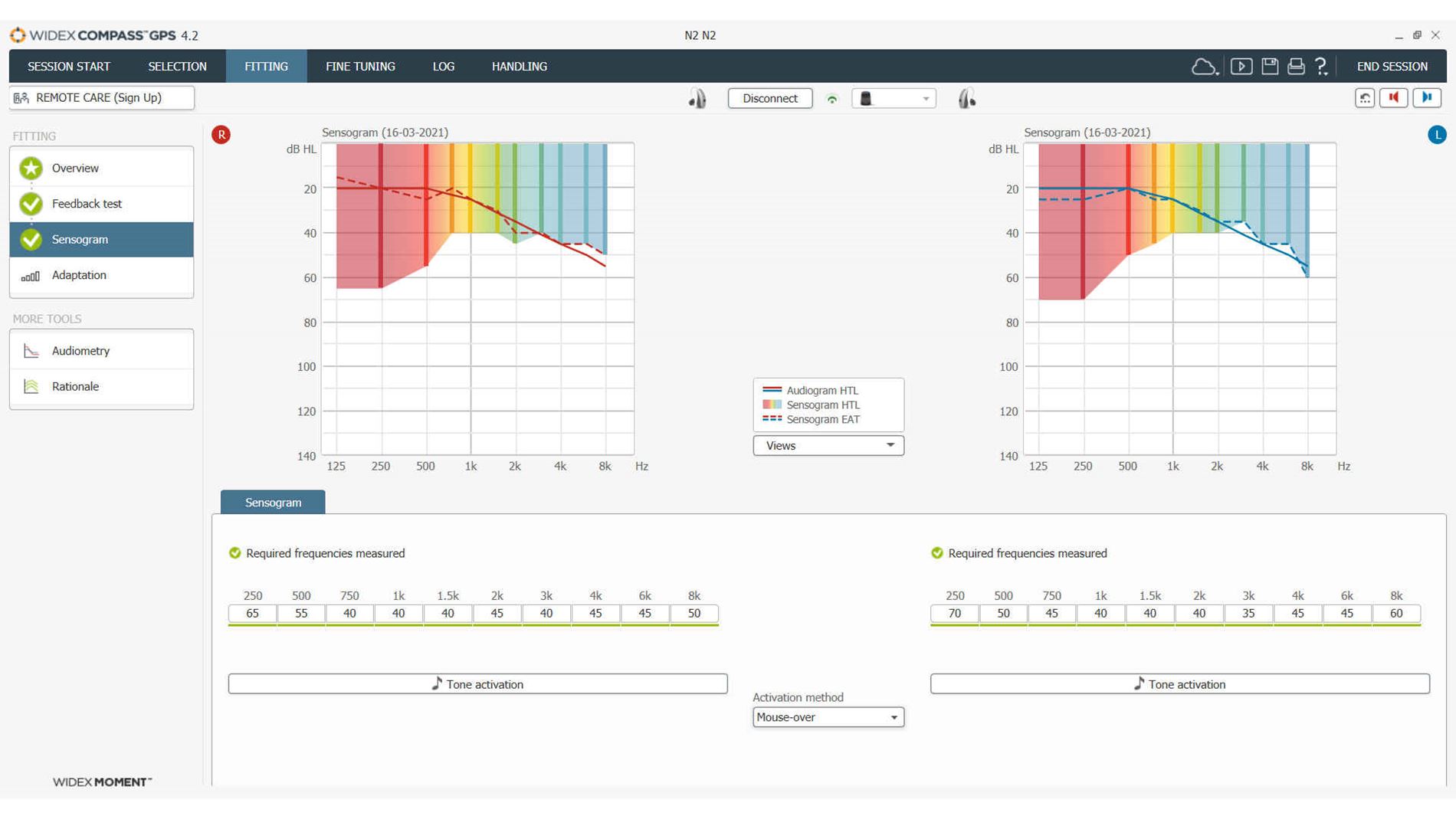 COMPASS Anpasssoftware | Widex Pro